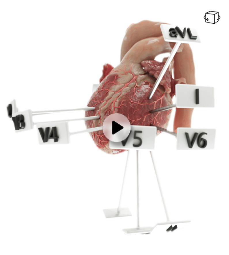 3D ECG Leads: 12 lead ECG placement made easy