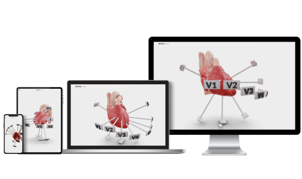 3D ECG Leads: 12 lead ECG placement made easy